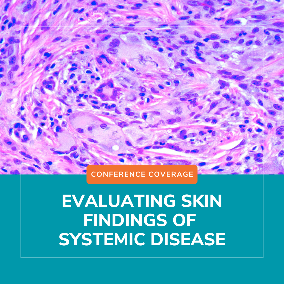 Evaluating Skin Findings of Systemic Disease | ODAC Dermatology Conference